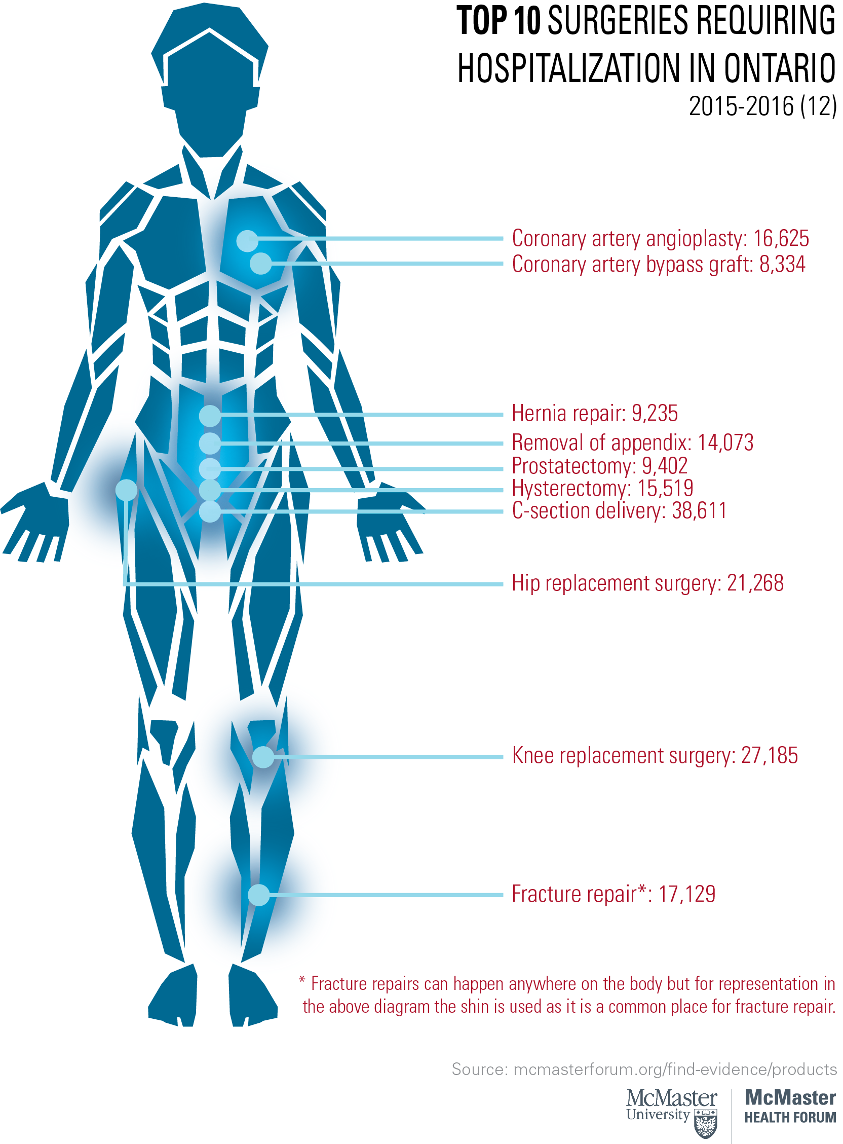Taking a Step Towards Achieving Worry-free Surgery in Ontario
